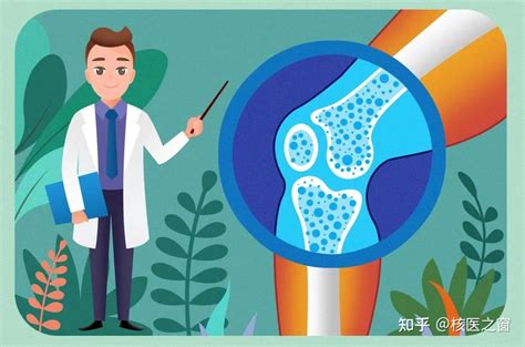 骨折早预防核医学科骨密度测定 知乎