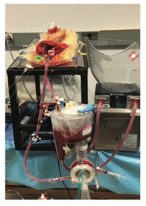 Pdf Limb Perfusion System Pdf Limb Perfusion System