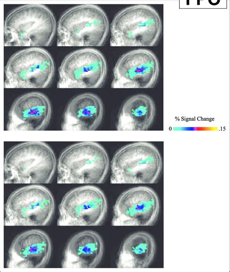 Activation In The Temporal Cortex Averaged Across Subjects The Top Download Scientific Diagram