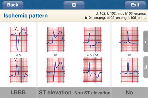 ECG Analysis IPhone And IPad Medical App Review