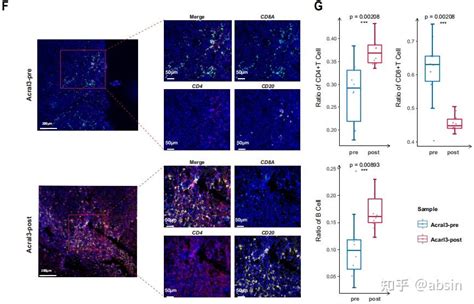 多色文献分享：探究黑色素瘤的肿瘤免疫微环境 知乎