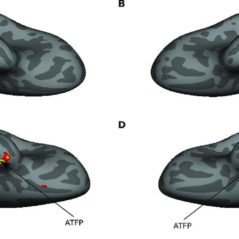 Face Selective Rois The Maps Show Significant Activations For Face Download Scientific Diagram