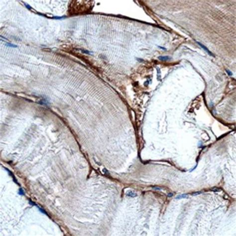 Hdystroglycan Aff Pur P 25 Ug