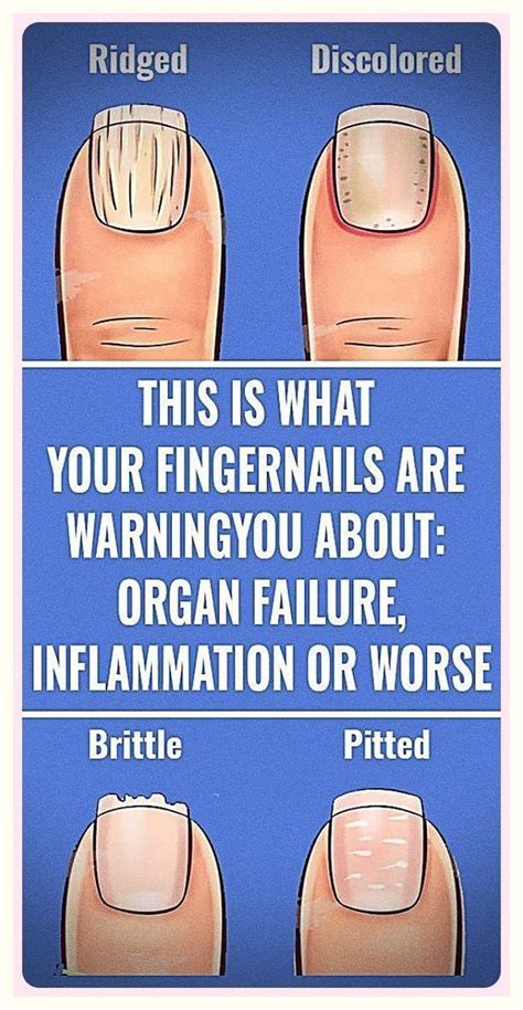 8 Important Signs Your Fingernails Can Tell About Your Health In 2022