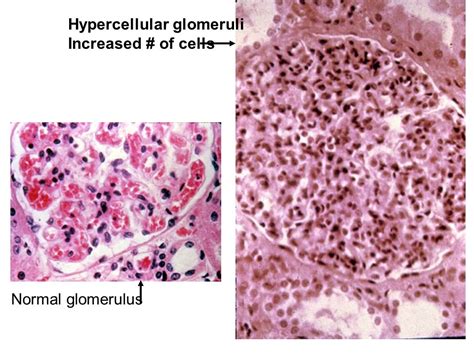 Renal Ultrastructure Atlas Ppt Video Online Download