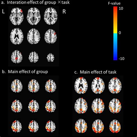 block design of the mental rotation task fixation comparison and