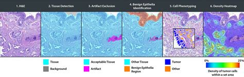 Lung Macrodissect Ai Indica Labs