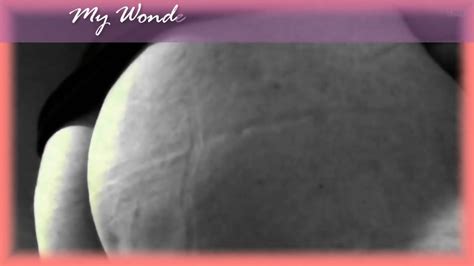 My Wonderful Bottom Eporner