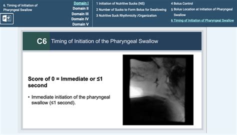 Modified Barium Swallow Assessment Modified Barium Swallow Assessment