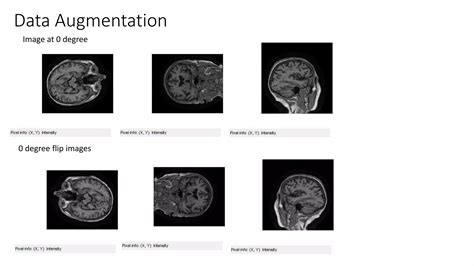 Alzheimers Disease Classification Using Deep Learning Neural A Network And Gamma Correction Pptx