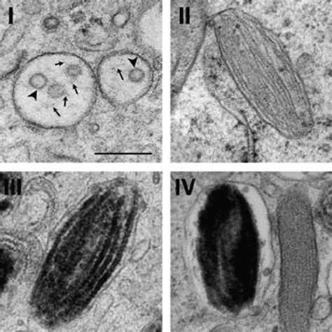 Functional Amyloids That Modulate Interface Transitions Download Scientific Diagram