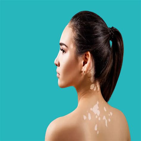 Ceporex 500 Mg 12 Tablets