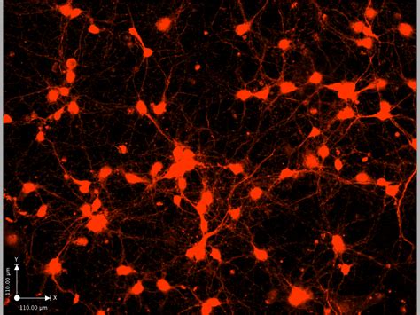 Problem With NeuN GFAP DAPI Triple Staining In Cortical Neuron Cultures