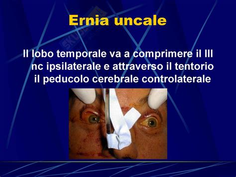 Approccio Al Paziente In Coma