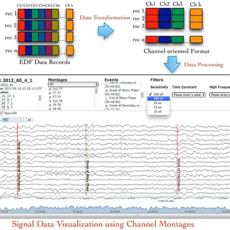 European Data Format Edf Files Store Signal Data As Contiguous Download Scientific Diagram