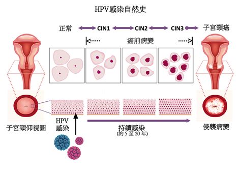 Hpv Self Sampling