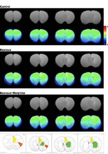 Figure 2 From Mapping Nociceptive Pathways Using Activity Dependent Manganese Enhanced Mri