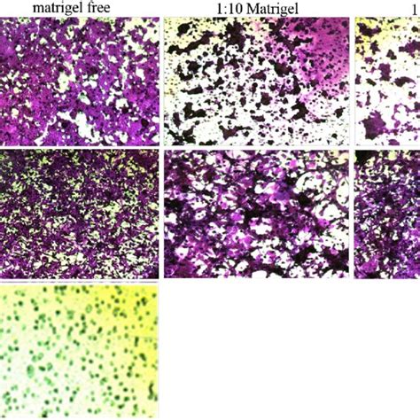 Photographs Of Polycarbonate Filters Coated With Matrigel From Download Scientific Diagram