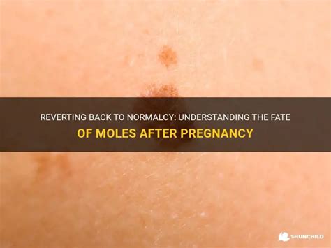 Reverting Back To Normalcy Understanding The Fate Of Moles After