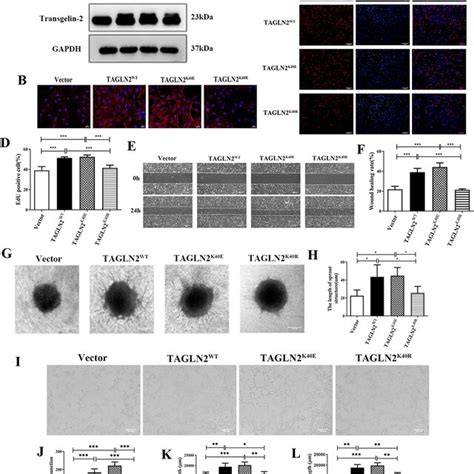 Upregulation Of Lysine Succinylation On Tagln2 Protein Is Confirmed A