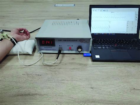 Wrist Pulse Signal Acquisition Download Scientific Diagram