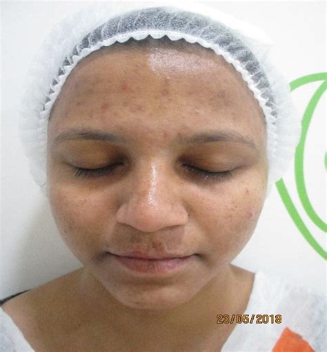 gallery archive oliva skin and hair care clinics