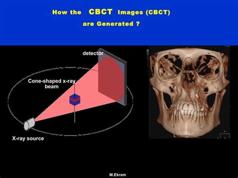 Basic Applications Of Cbct Ppt 3 D Graphics Computer Software And
