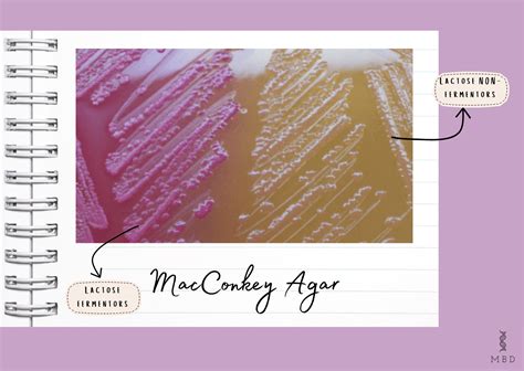 Macconkey Agar Lactose Fermentation