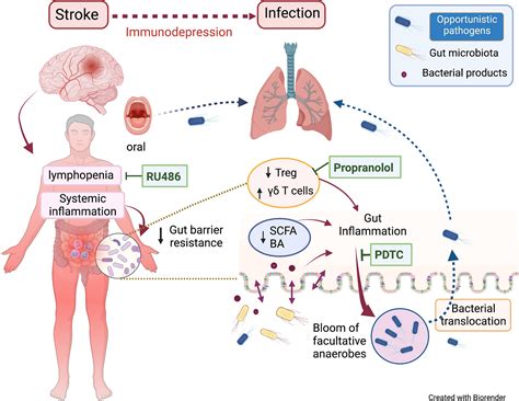 Poststroke Lung Infection By Opportunistic Commensal Bacteria Is Not