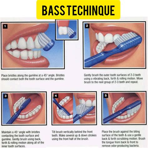 Brushing Techniquemodified Bass Your Everyday Dentist Facebook