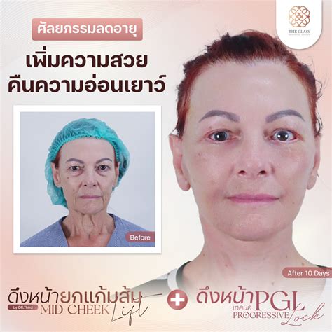 The Class Aesthetic Center The Class Aesthetic Center