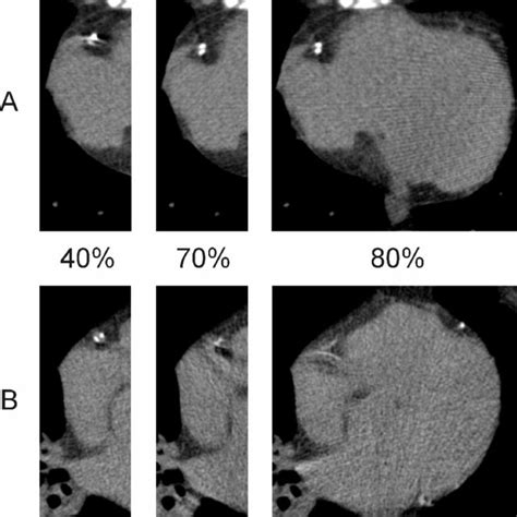 2 Contrast Medium Injection Protocol Download Table