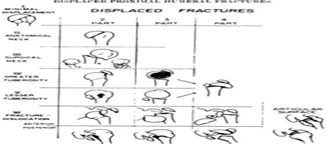 Clinical Orthopaedics And Related Research®