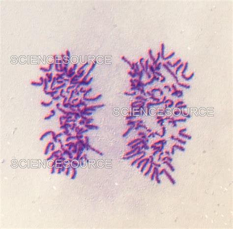 Mitosis Light Micrograph Stock Image Science Source Images