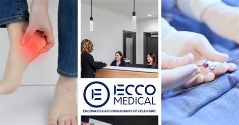 What Is Embolization Definition Benefits And Risks Ecco