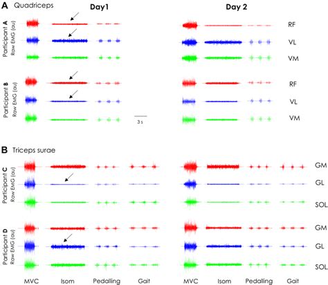 Individual Examples Of The Raw Surface Electromyographic Signals