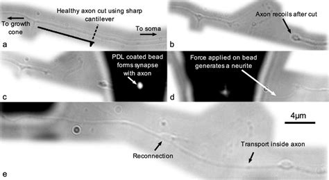 Axotomy And Reconnection A A Single Healthy Axon Is Cut Along The