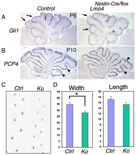 Transcription Factor Lmo Defines The Shape Of Functional Areas In Developing Cortices And