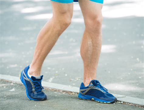 Varicose Veins Vs Spider Veins Understanding The Key Differences