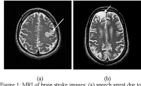 Figure 1 From Pre Processing Investigation For Brain Abnormality Detection And Analysis Through