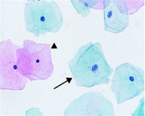 Diagnosis And Treatment Of Cancer Flashcards Quizlet