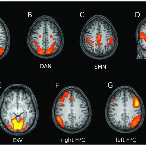 Resting State Networks Obtained From Ica Resting State Networks