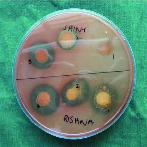 Photograph Showing Streptococcus Mutans Colonies On Mitis Download Scientific Diagram
