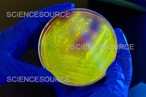 Clostridium Difficile Bacteria Cultur Stock Image Science Source