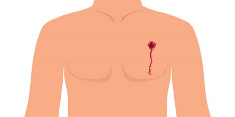 300 Gunshot Wound Stock Illustrations Royalty Free Vector Graphics