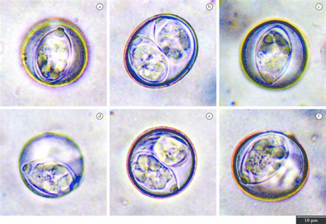 Photographs Of Sporulated Oocysts Of Coccidia Species Recovered From