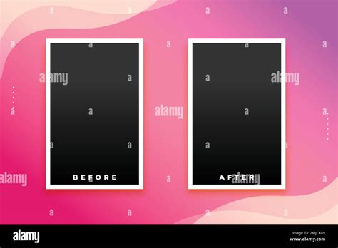 Comparison Before And After Photo Frame Gradient Background Vector Stock Vector Image And Art Alamy