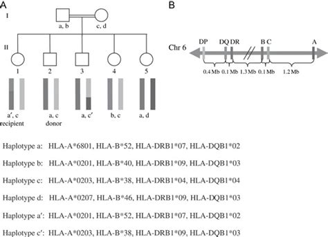 Human Leukocyte Antigen Hla Haplotypes In A Patient With Acute Download Scientific Diagram