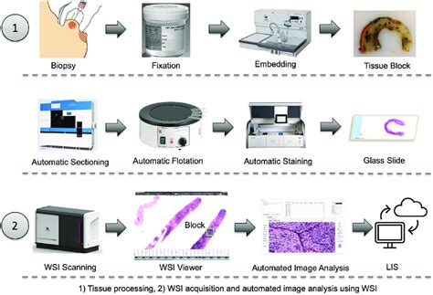 Digital Pathology Workflow For Automated Image Analysis And Diagnosis