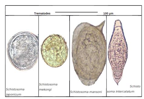 Solved Trematode Eggs Found In Stool Specimens Of Humans